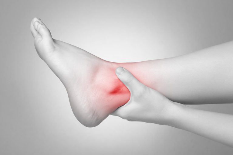 Soft Tissue Injuries - managing sprains and strains. Advice from a ...